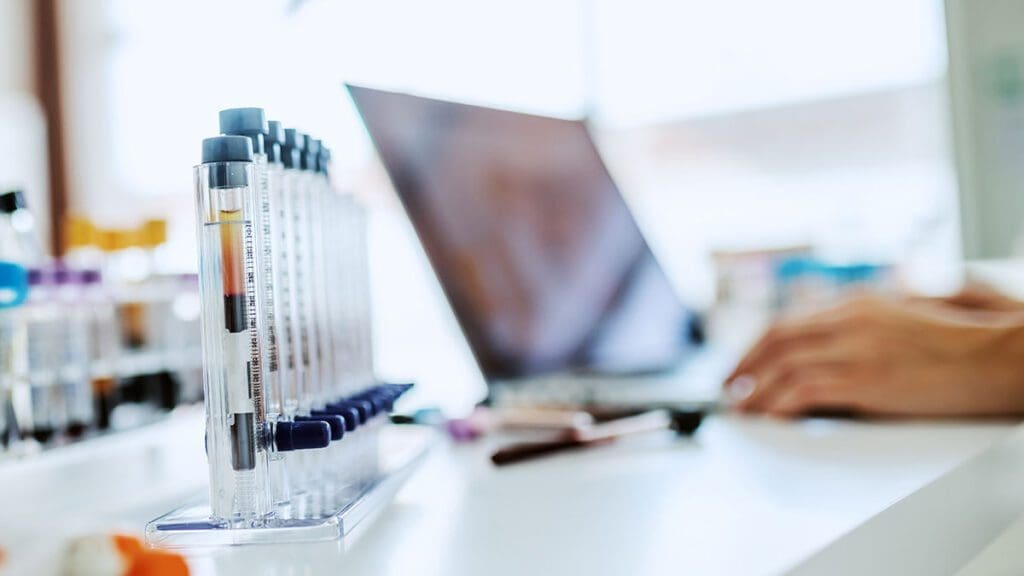 Overwhelmed to Organized: Navigating Cancer Care Research with NVivo ...